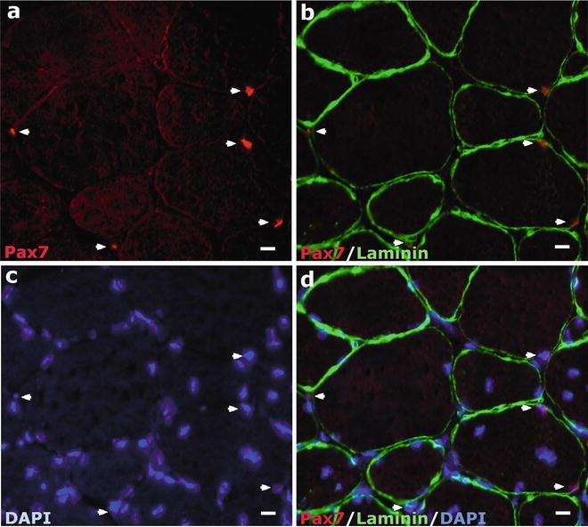 Isolation, Cryosection and Immunostaining of Skeletal Muscle | SpringerLink