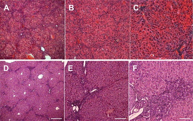 Optimized Mouse Models for Liver Fibrosis | SpringerLink