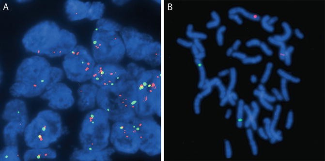 Fluorescence In Situ Hybridization Of Cells Chromosomes And Formalin
