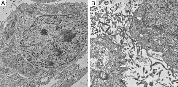 Electron Microscopy of Ebola Virus-Infected Cells | SpringerLink