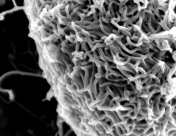 Electron Microscopy of Ebola Virus-Infected Cells | SpringerLink