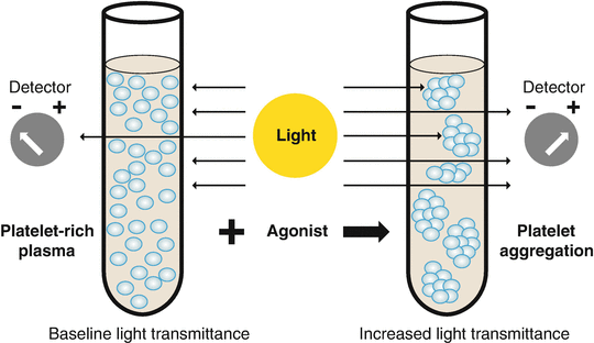 Platelet Function Tests: Preanalytical Variables, Clinical Utility ...