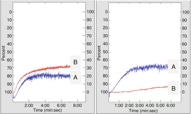 Ristocetin-Induced Platelet Aggregation (RIPA) and RIPA Mixing Studies ...