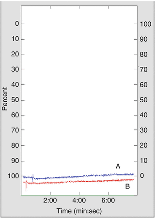 Ristocetin-Induced Platelet Aggregation (RIPA) and RIPA Mixing Studies ...