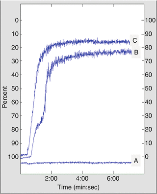 Ristocetin-Induced Platelet Aggregation (RIPA) and RIPA Mixing Studies ...