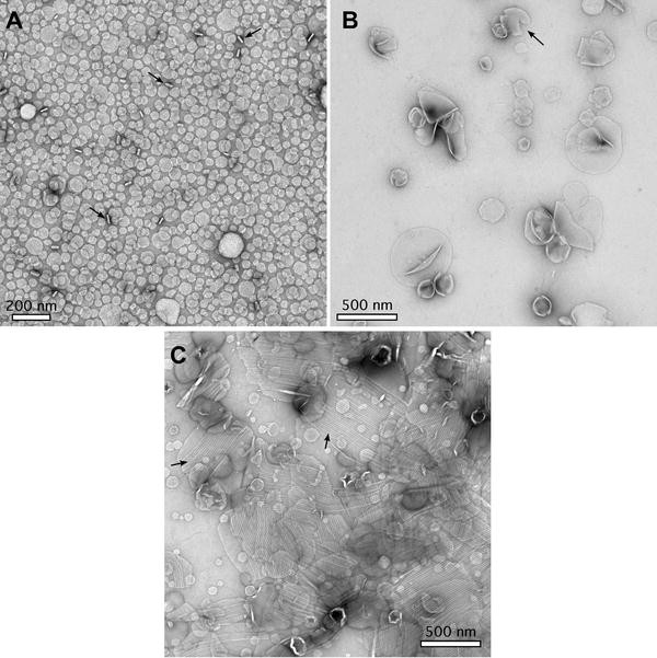 Imaging of Liposomes by Transmission Electron Microscopy | SpringerLink