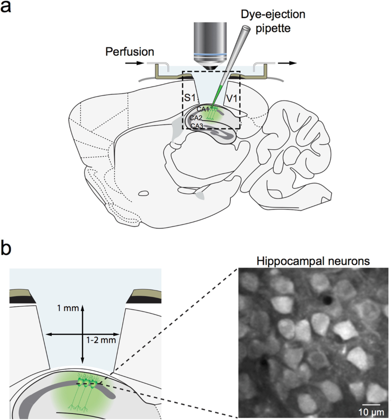 In Vivo Two-Photon Calcium Imaging of Hippocampal Neurons in Alzheimer ...