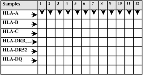 HLA Typing with Sequence-Specific Oligonucleotide Primed PCR (PCR-SSO ...