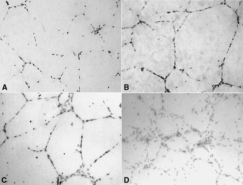 Tube Formation: an In Vitro Matrigel Angiogenesis Assay | SpringerLink