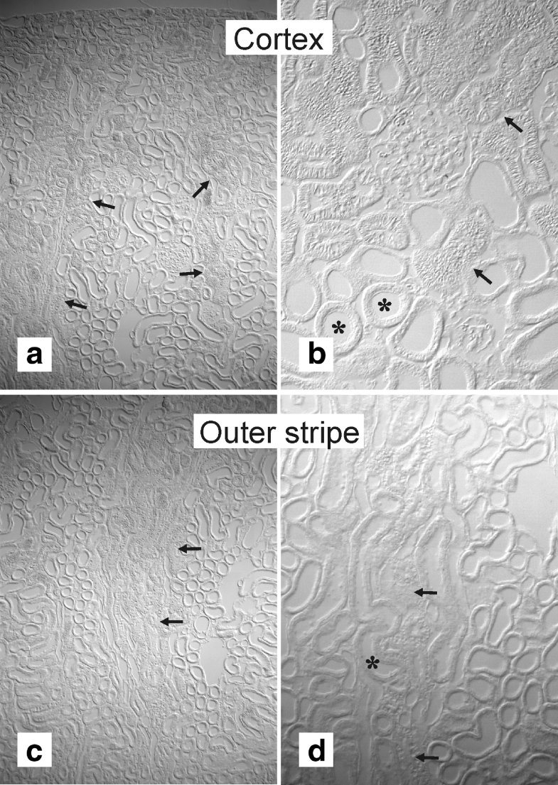 Pimonidazole Adduct Immunohistochemistry in the Rat Kidney: Detection ...