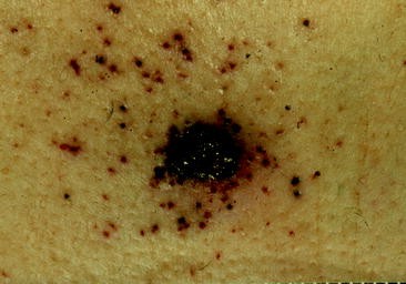 Gunshot Wound Deaths | SpringerLink