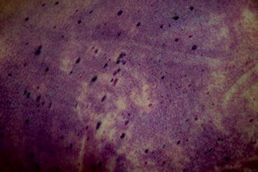 Postmortem Changes and Time of Death | SpringerLink