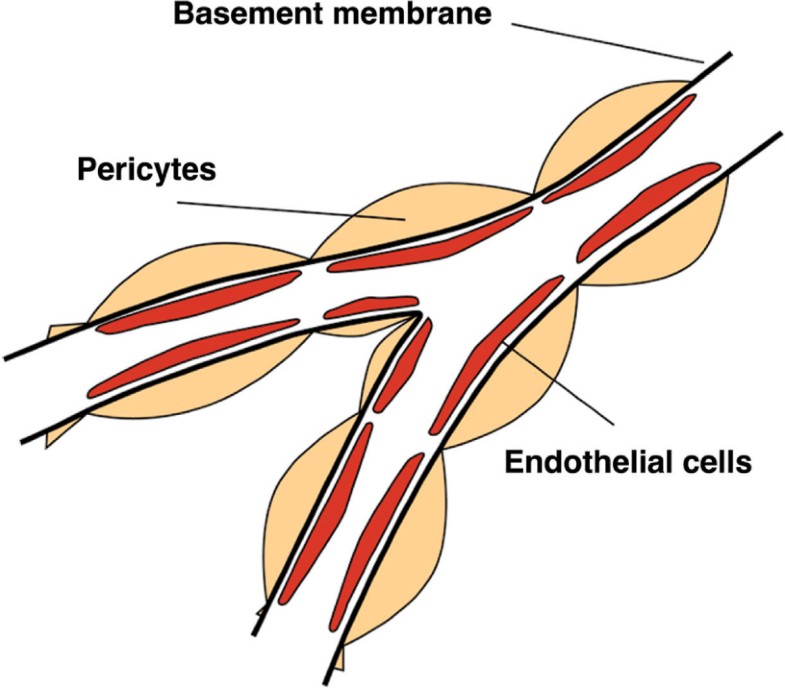 Capillary Dropout in Diabetic Retinopathy | SpringerLink