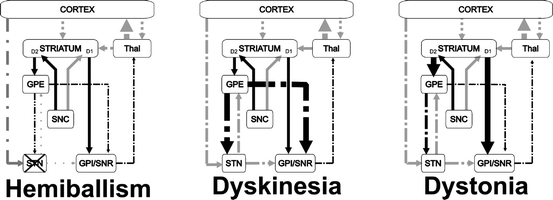 Pathophysiology of Hyperkinetic Movement Disorders | SpringerLink