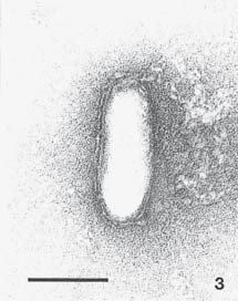 Basic Phage Electron Microscopy | SpringerLink