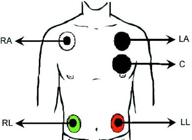 Basic ECG Theory, 12-Lead Recordings and Their Interpretation ...
