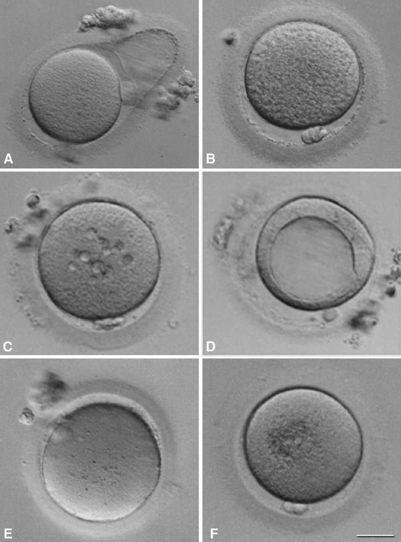 Human Oocyte Abnormalities: Basic Analyses and Clinical Applications ...