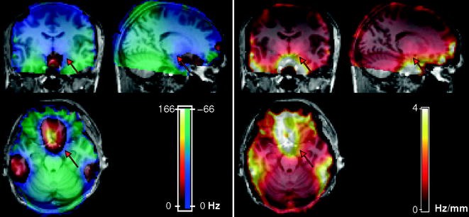 fMRI of Emotion | SpringerLink