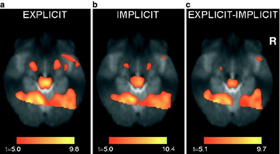 fMRI of Emotion | SpringerLink