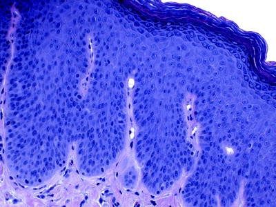 Lesions of the Vulva and Vagina | SpringerLink