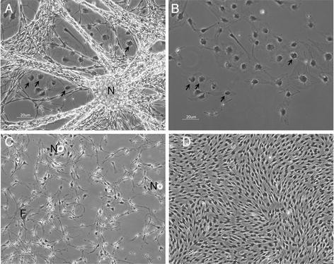 Primary Schwann Cell Cultures | SpringerLink