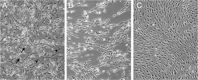 Primary Schwann Cell Cultures | SpringerLink