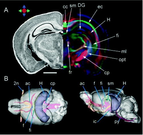Magnetic Resonance Imaging-Based Mouse Brain Atlas and Its Applications ...