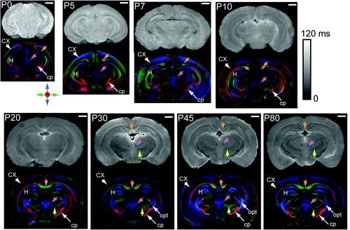 Magnetic Resonance Imaging-Based Mouse Brain Atlas and Its Applications ...