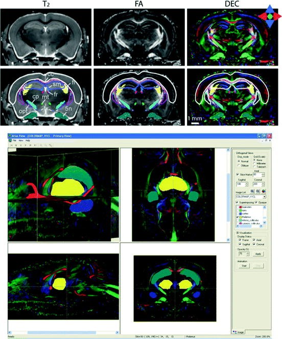 Magnetic Resonance Imaging-Based Mouse Brain Atlas and Its Applications ...