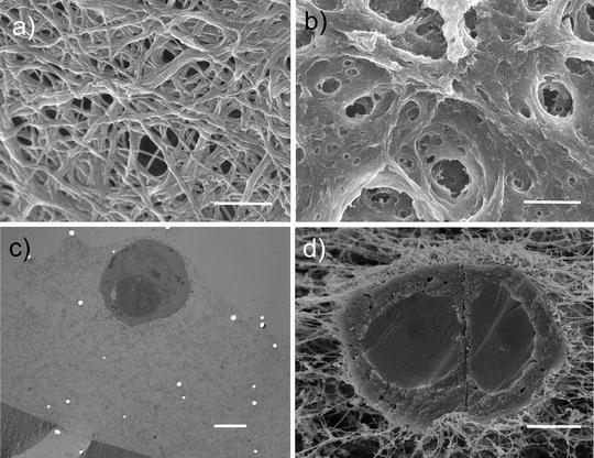 Transwell® Invasion Assays | SpringerLink