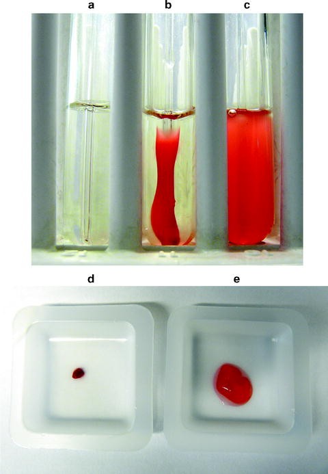 Clot Retraction | SpringerLink