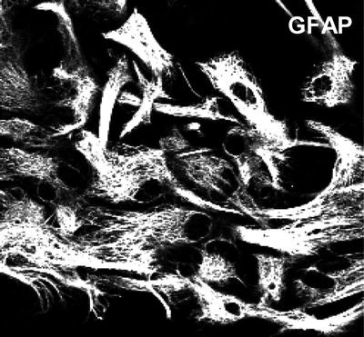 Isolation and Culture of Neurons and Astrocytes from the Mouse Brain ...