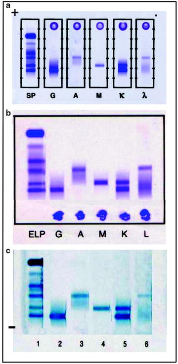 Immunofixation Electrophoresis for Identification of Proteins and ...