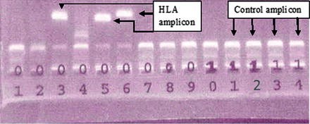 HLA Typing by SSO and SSP Methods | SpringerLink