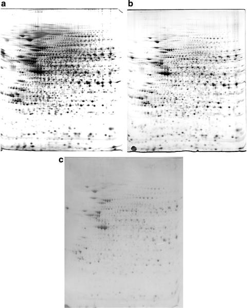 Silver Staining of 2D Electrophoresis Gels | SpringerLink