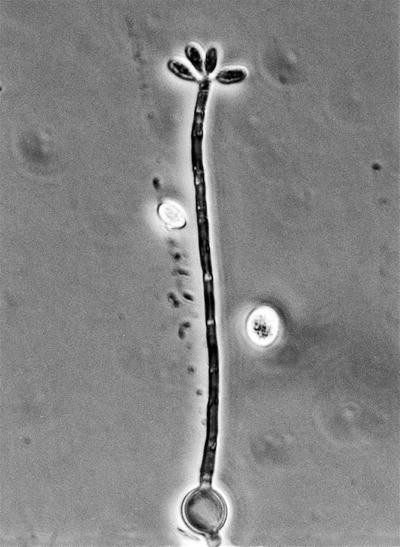 Genetic Manipulation of Xanthophyllomyces dendrorhous and Phaffia ...