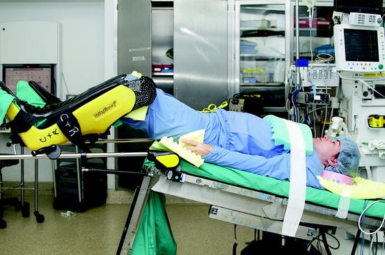 General Complications of Pelvic Reconstructive Surgery | SpringerLink