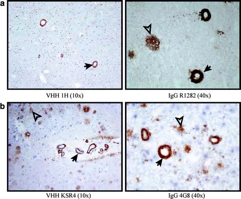 Selection of VHH Antibody Fragments That Recognize Different Aβ ...