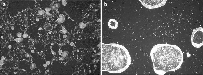 Techniques in Embryoid Body Formation from Human Pluripotent Stem Cells ...