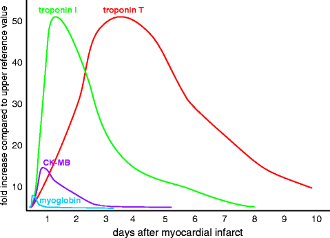Sensible Use of High-Sensitivity Troponin Assays | SpringerLink