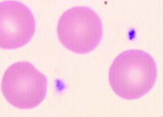 Platelet Morphology Analysis | SpringerLink