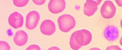 Platelet Morphology Analysis | SpringerLink
