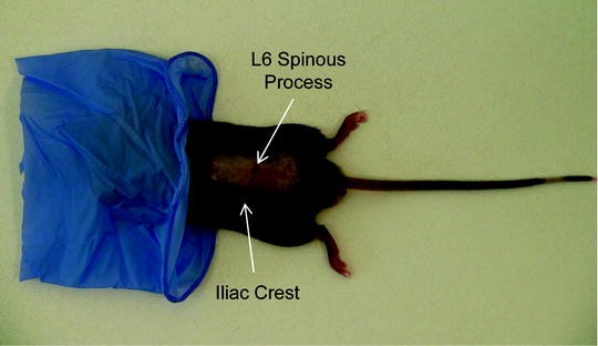 Direct Intrathecal Drug Delivery in Mice for Detecting In Vivo Effects ...