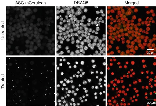ASC Speck Formation as a Readout for Inflammasome Activation | SpringerLink