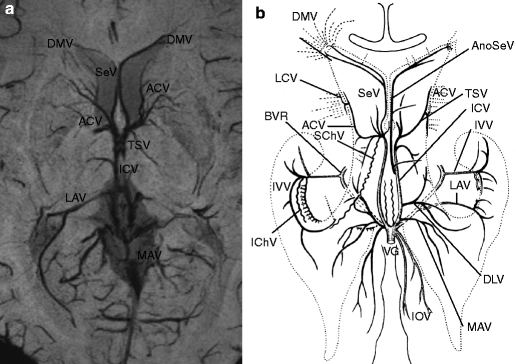Normal Anatomy of Intracranial Veins: Demonstration with MR Angiography ...