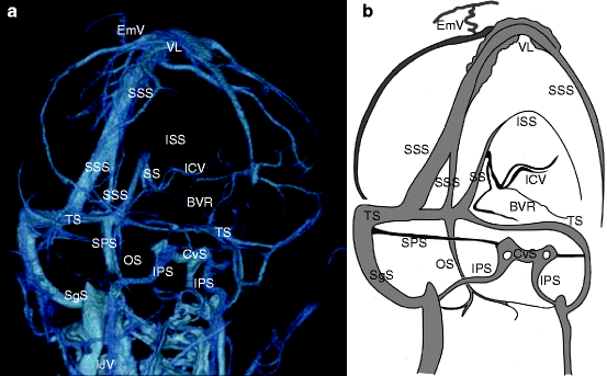 Normal Anatomy of Intracranial Veins: Demonstration with MR Angiography ...