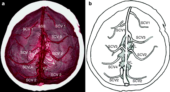 Normal Anatomy of Intracranial Veins: Demonstration with MR Angiography ...