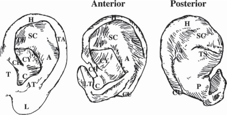 Auricular Reconstruction for Microtia | SpringerLink