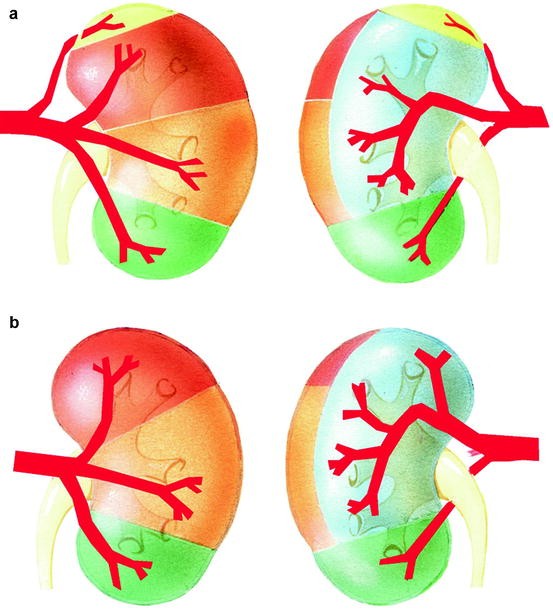 Renal Anatomy, Physiology and Its Clinical Relevance to Partial ...