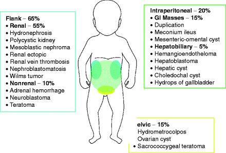 Approach to Abdominal Masses | SpringerLink